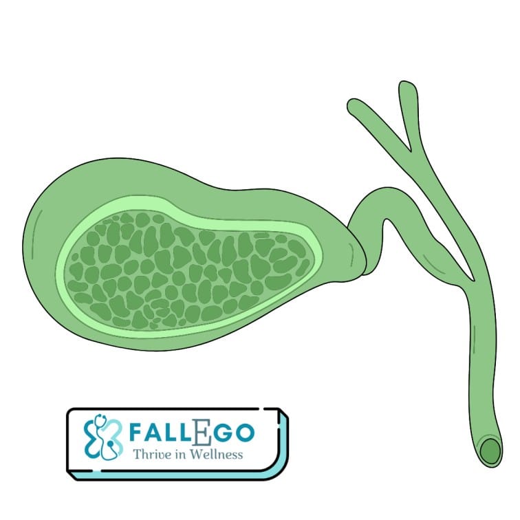 Trusted & Advanced Gall Stone Disease Call us 03339025207